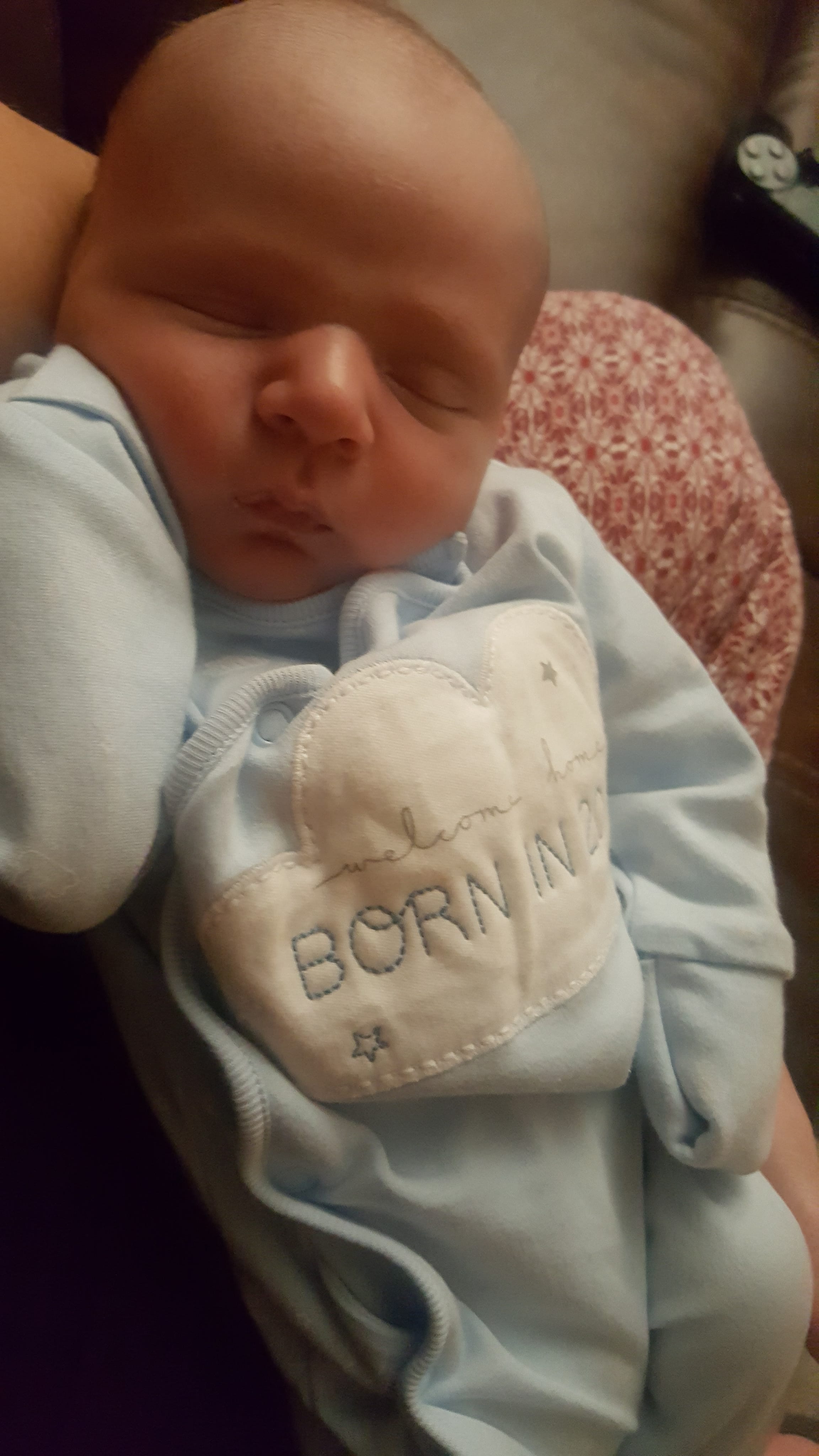 Amazing Story of Baby Jack; Born With One Hand | Window to the Womb ...